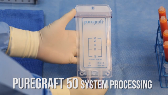 Puregraft 50 In-Service Video - Puregraft - The Fat Transfer Experts